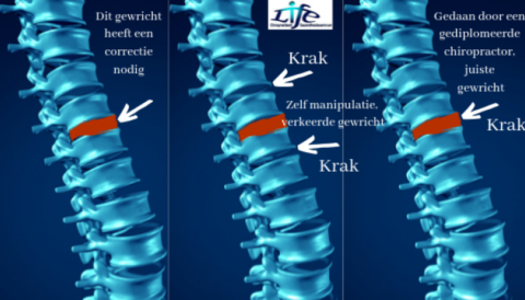 Je nek zelf manipuleren? Een slecht idee! - Life Chiropractie